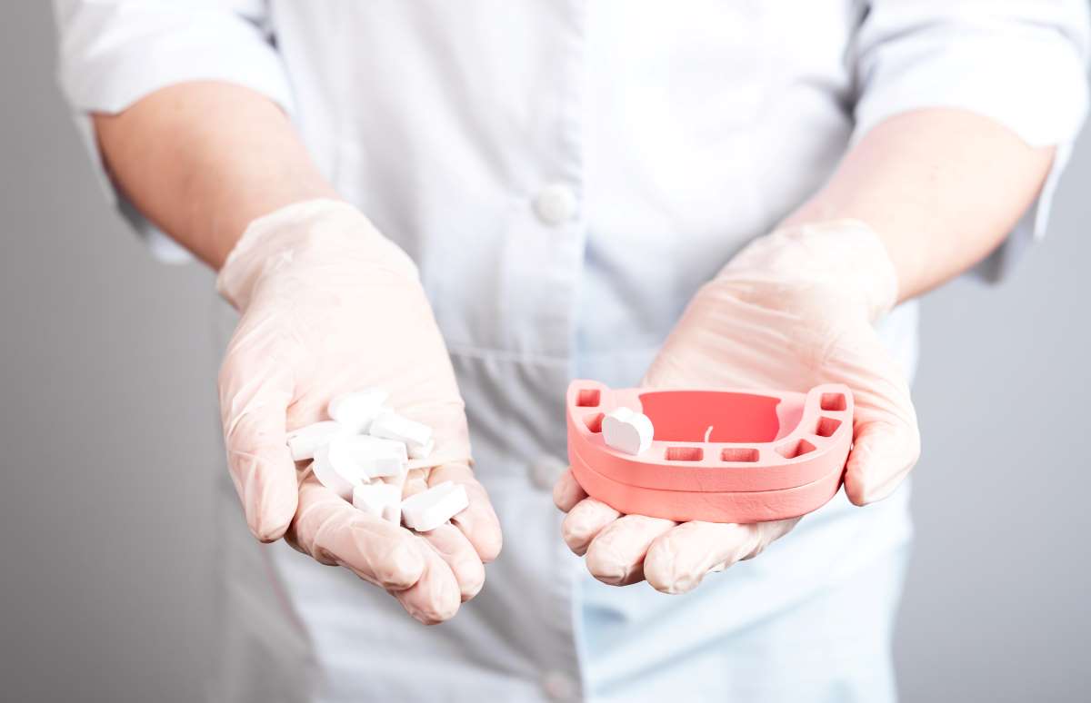 A fogágy gyulladás tünetei, lefolyása, kezelési lehetőségek - Dentpoint